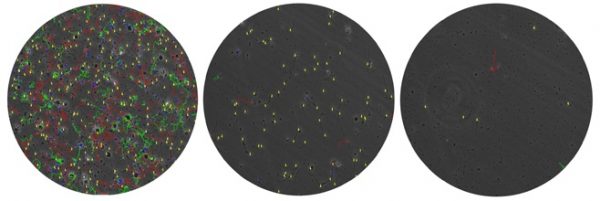 Azoospermie et asthénozoospermie: définition et traitement | Eugin